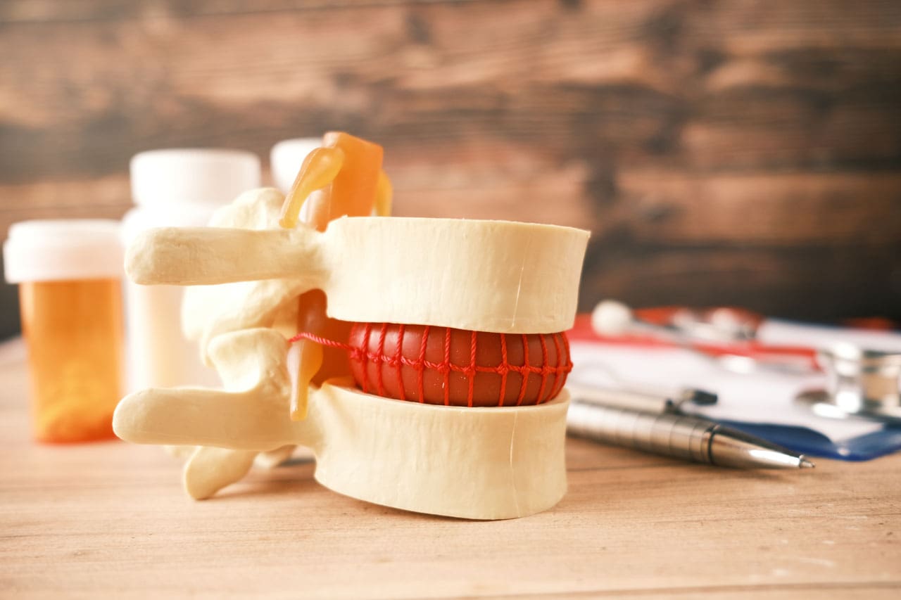 Maintaining a Healthy Spine: Exploring Intervertebral Disc Health ...